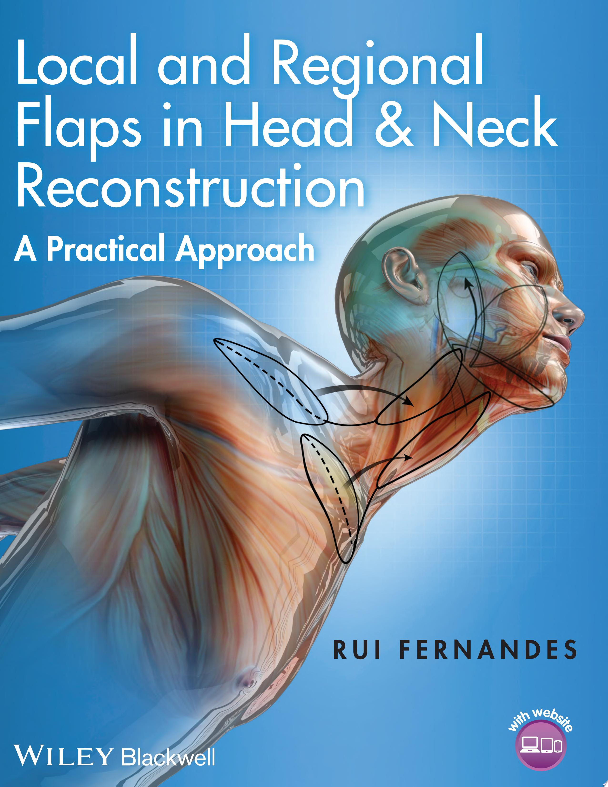 Local and Regional Flaps in Head & Neck Reconstruction: A Practical Ap ...